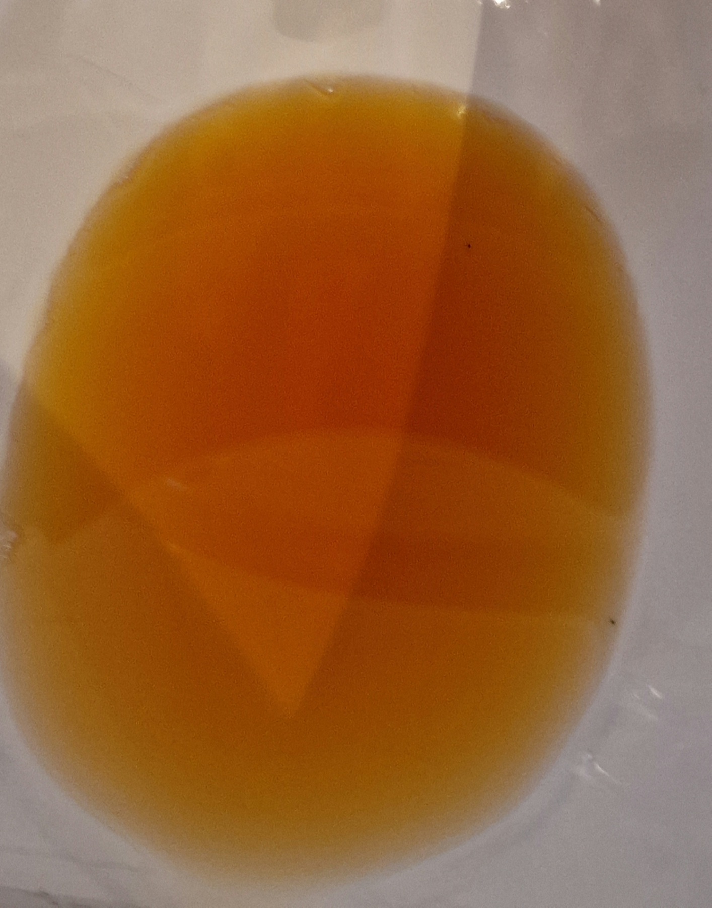 Rare kleur urine - Medische Forum - Dokter.nl